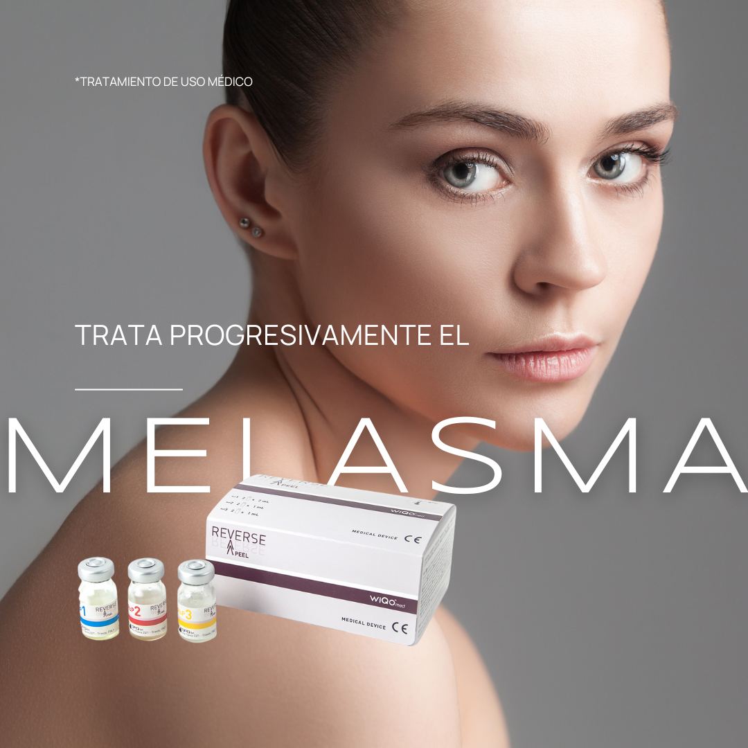 Reversee Peel: la solución perfecta para tratar el melasma y la ...