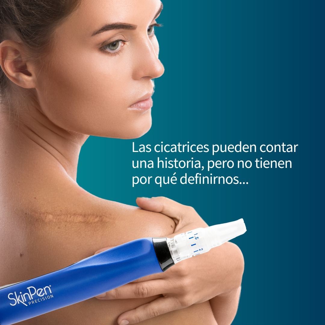 Tres nuevas indicaciones de SkinPen Precision para tu piel